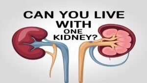 Can You Live With One Kidney? Real-Life Examples and Guide