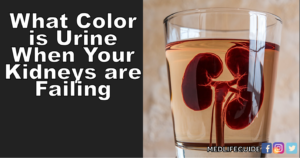 What Color Is Urine When Your Kidneys Are Failing?