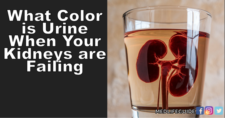 What Color Is Urine When Your Kidneys Are Failing?