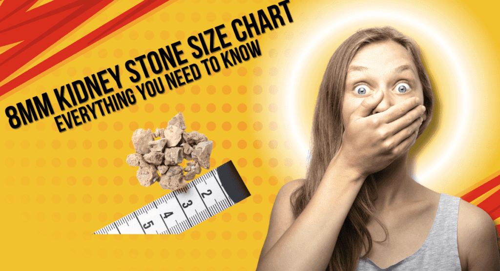 The 8mm Kidney Stone Size Chart: Everything You Need to Know